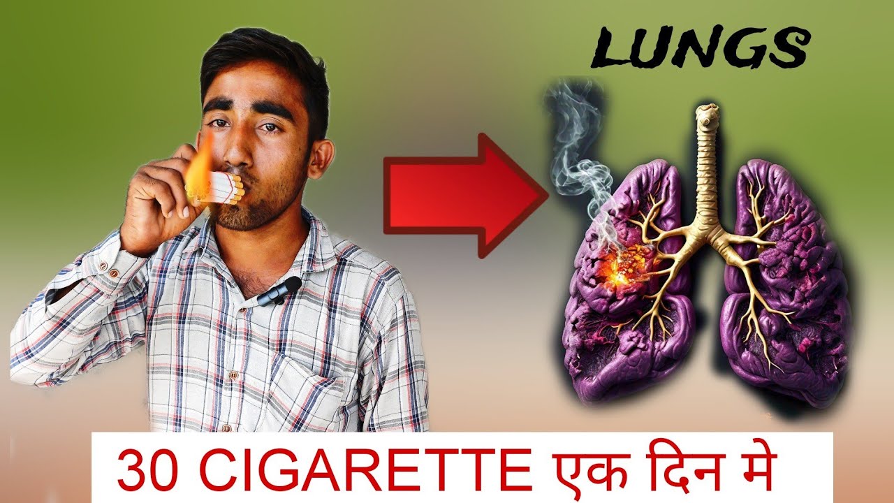 Is It OK to Smoke 30 Cigarettes? 30 सिगरेट पीने पे क्या होगा? एक दिन मे ...