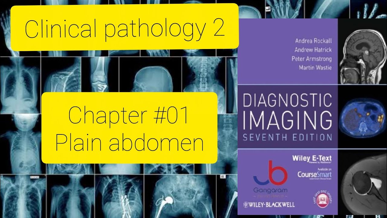 Plain abdomen //Lec 02// clinical pathology 2// radiology - YouTube