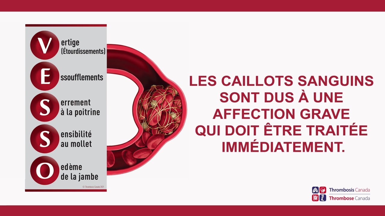 VESSO Clip d'introduction - YouTube