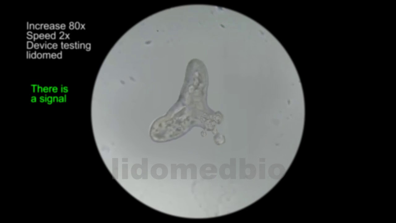 Bio Resonance Technology in action - YouTube