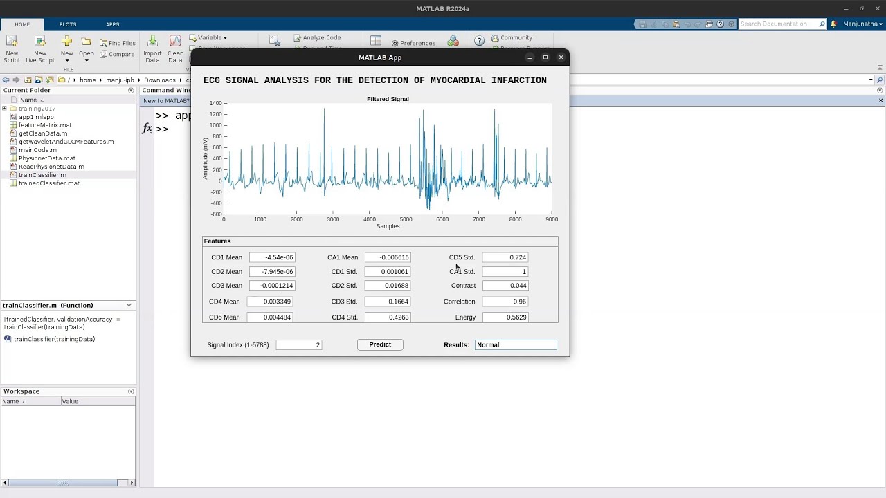ECG Signal Analysis for the Detection of Myocardial Infarction - YouTube