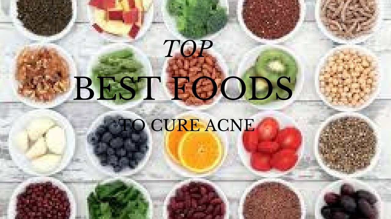 Top Best foods that can cure acne/pimple permanently....Results ...