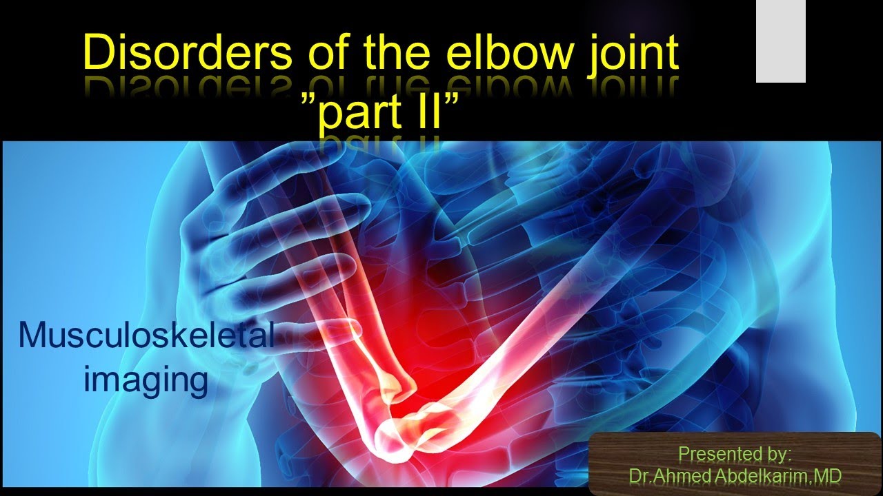 5-Disorder of the elbow joint (part 2) - YouTube