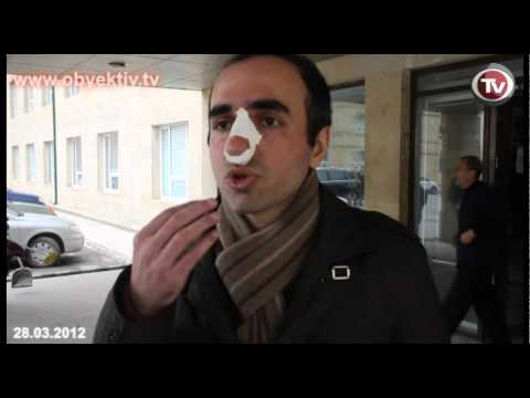 EVİ SÖKÜLƏN GƏNCİN BURNUNU DA SINDIRDILAR