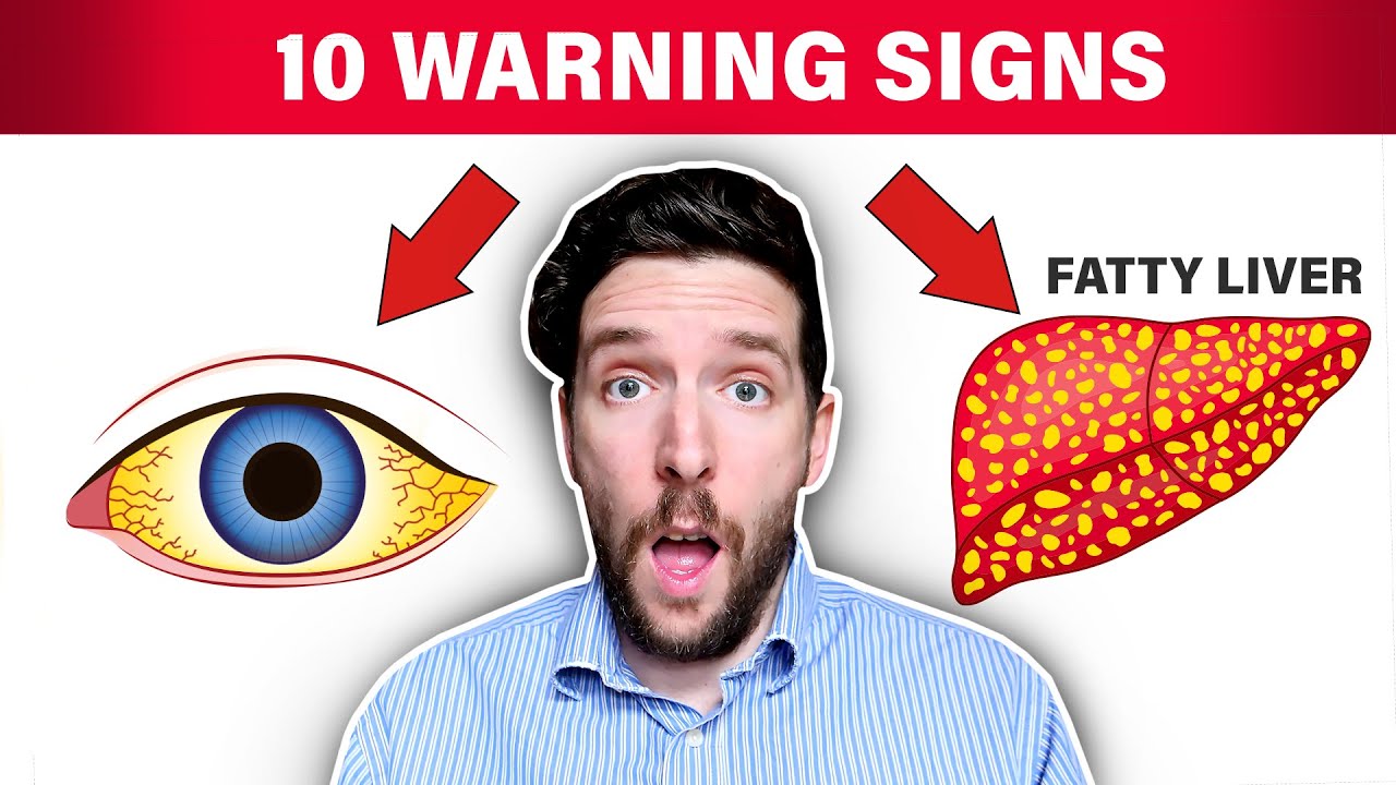 10 WARNING Signs That Your Liver Is Toxic - YouTube