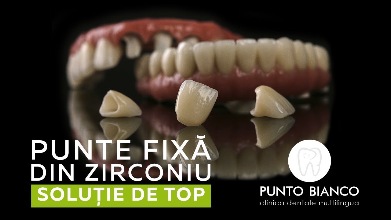 Punte Fixă din zirconiu | Soluție de Top - YouTube