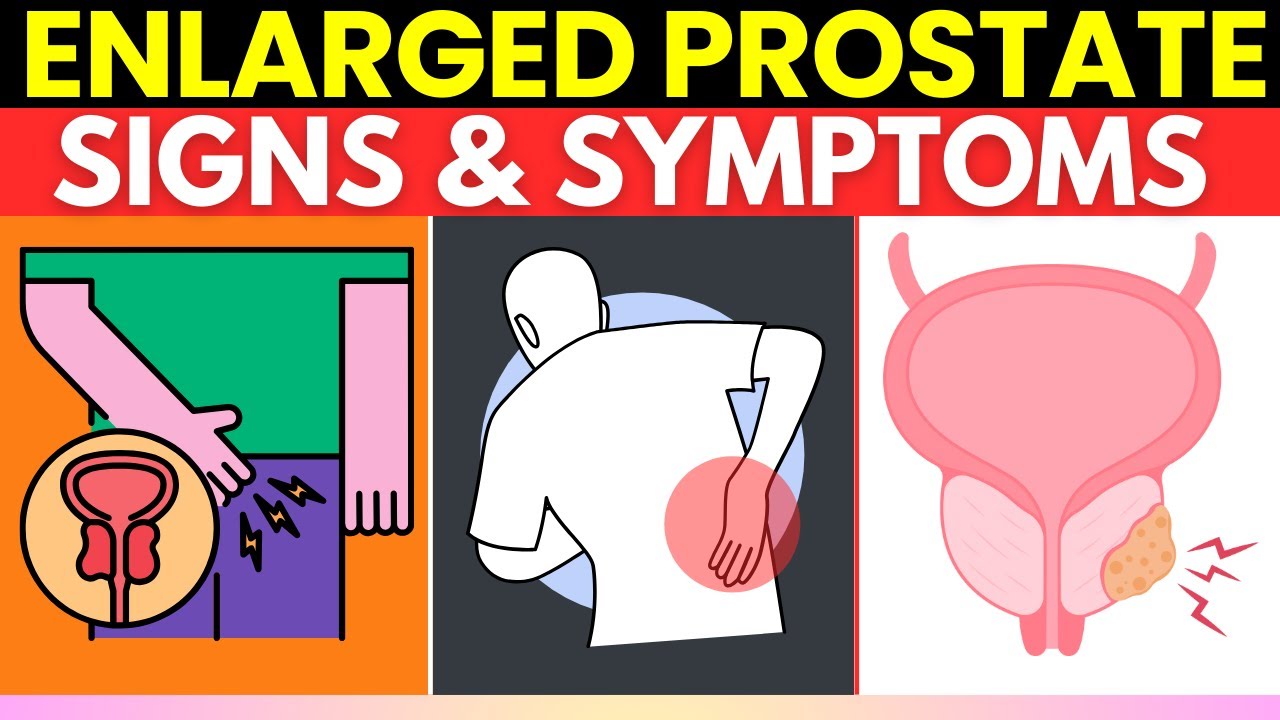 Enlarged Prostate (BPH) - Signs & Symptoms | Every Man Should Know ...
