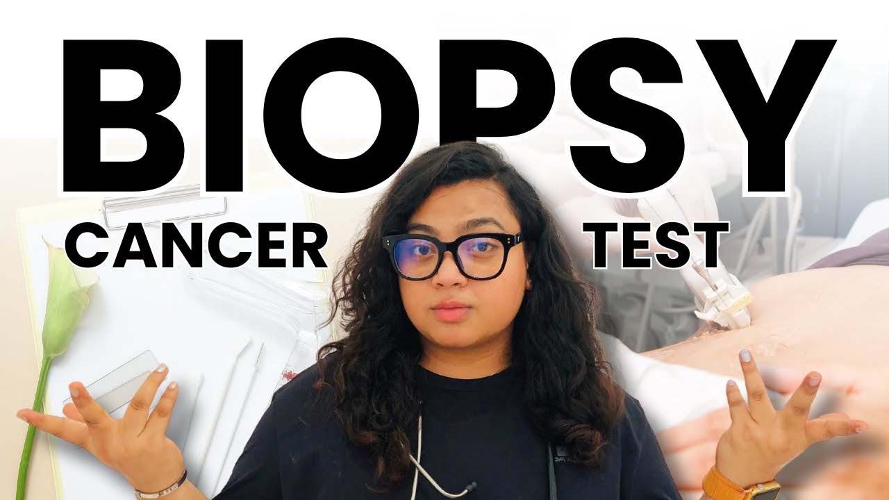 Cancer Biopsy Test Procedure - How Biopsy is Done for Skin, Prostate or ...