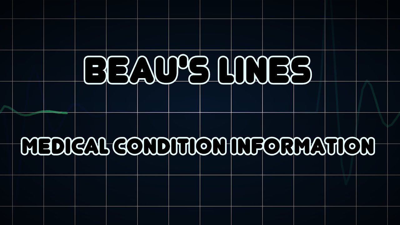 Beau's lines (Medical Condition) - YouTube