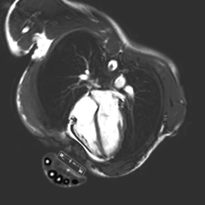 pressed heart - YouTube