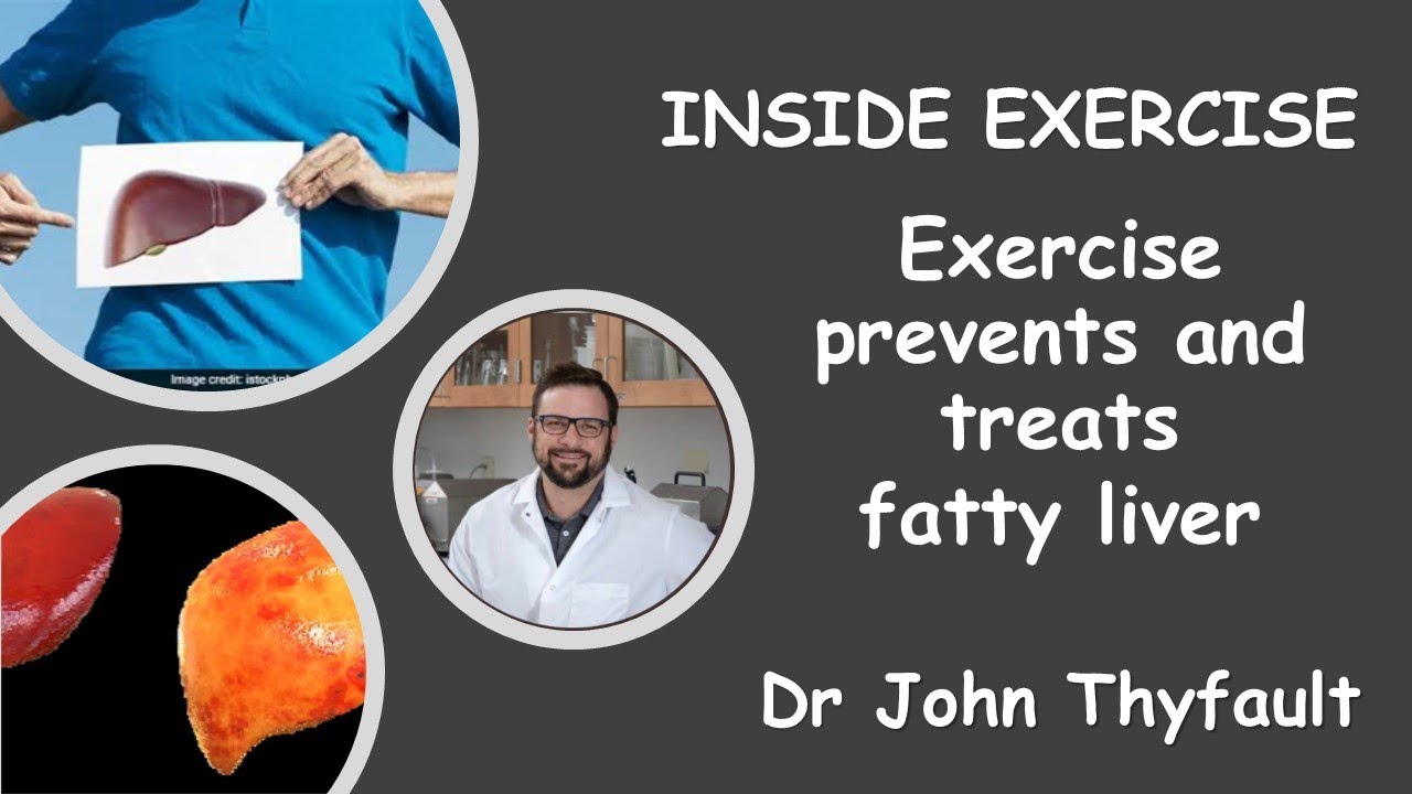 #28 - Exercise protects and treats fatty liver with Dr John Thyfault ...