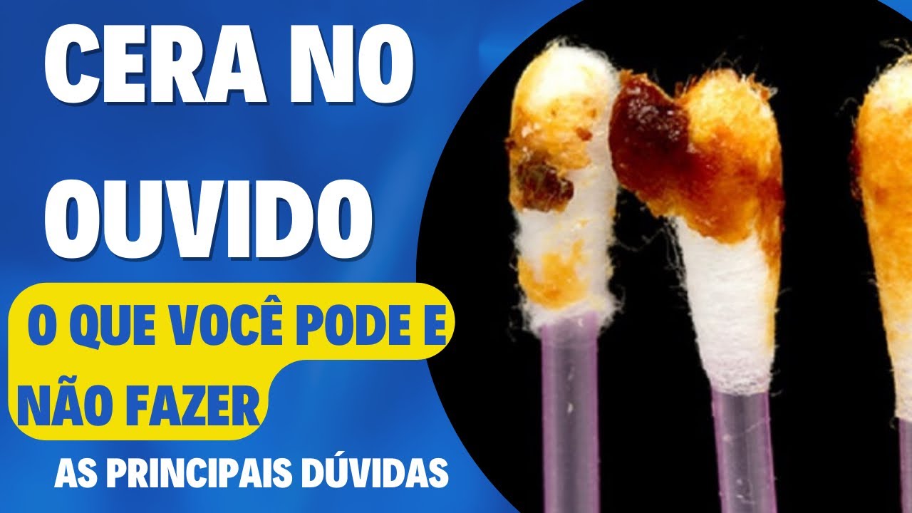 Cera no ouvido é sujeira ou proteção? Pode tirar cerume na orelha com ...