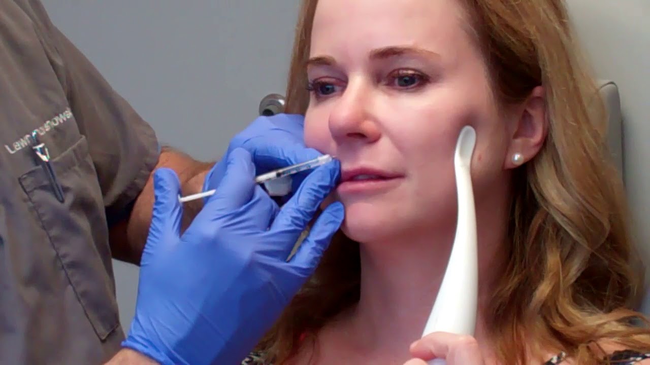Pain-less, Lovely Lip Fillers with Dr. Janowski at Sonata - YouTube