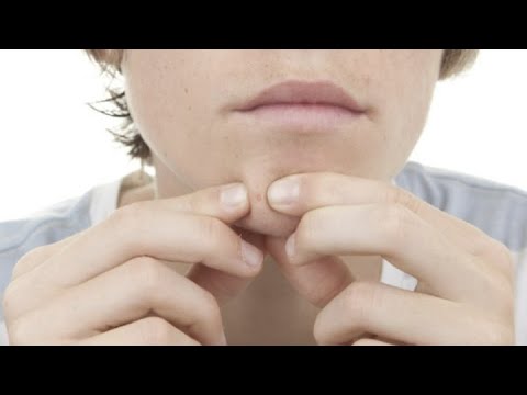 Эффективное дуа от прыщей! - YouTube