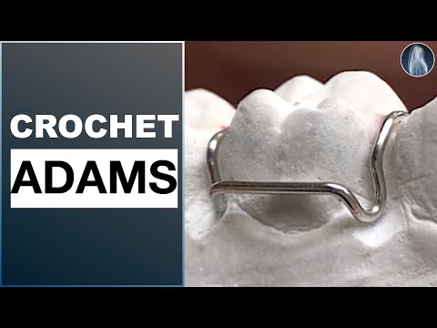 Crochet Adams | Orthèse dentaire | Orthodontie | © - YouTube