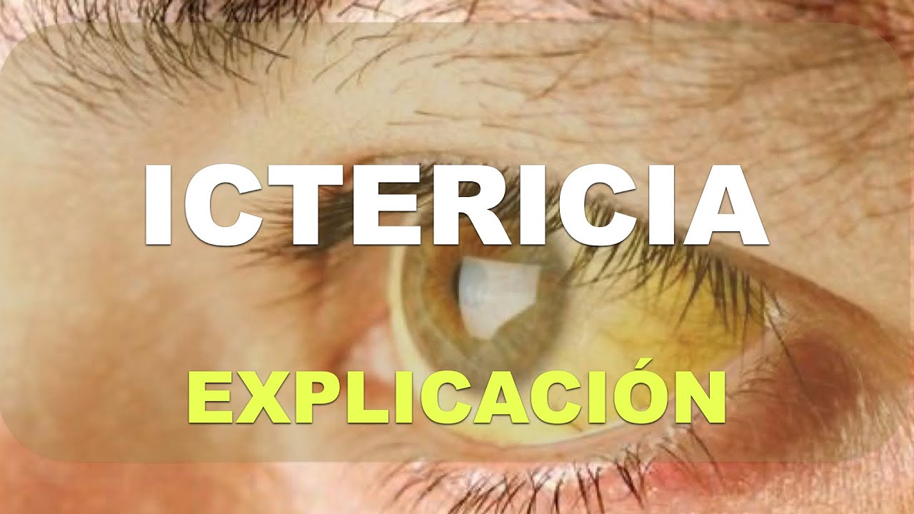 ¿Qué es la ictericia y por qué se produce? - YouTube