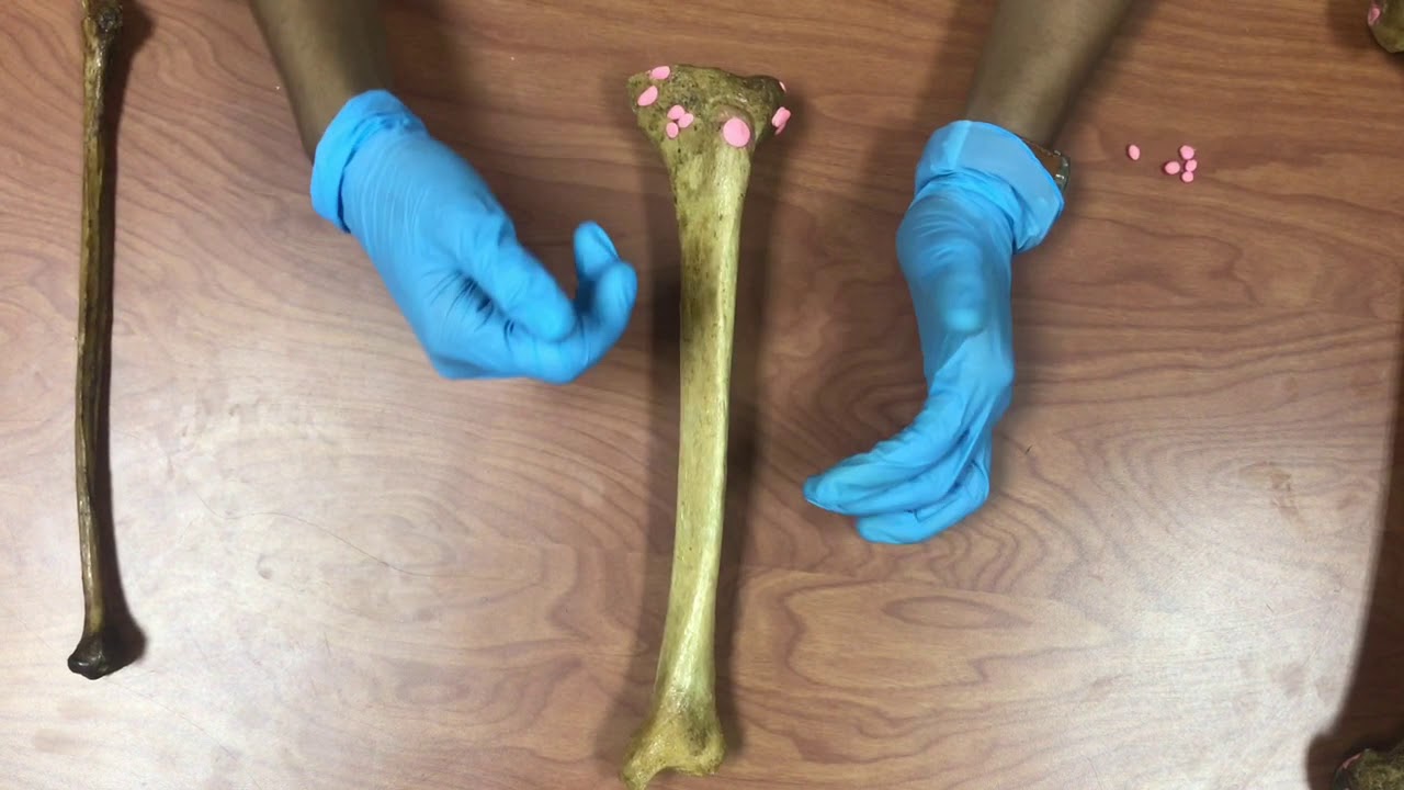 HUESO TIBIA - PRACTICA ANATOMIA (TUBERCULO DE JARDY- TUBERCULO TIBIAL ...