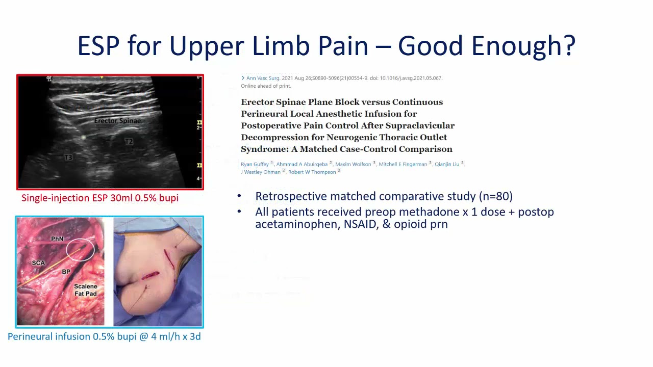 Erector Spinae Plane (ESP) Block for Upper Limb Pain - YouTube