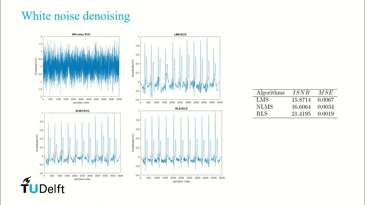 Presentation of the noise cancellation using adaptive filter - YouTube