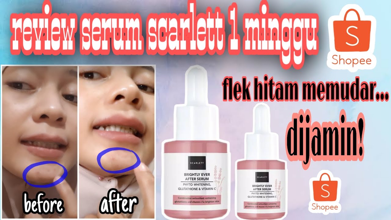 REVIEW SERUM WAJAH SCARLETT WHITENING , FLEK HITAM MEMUDAR - YouTube