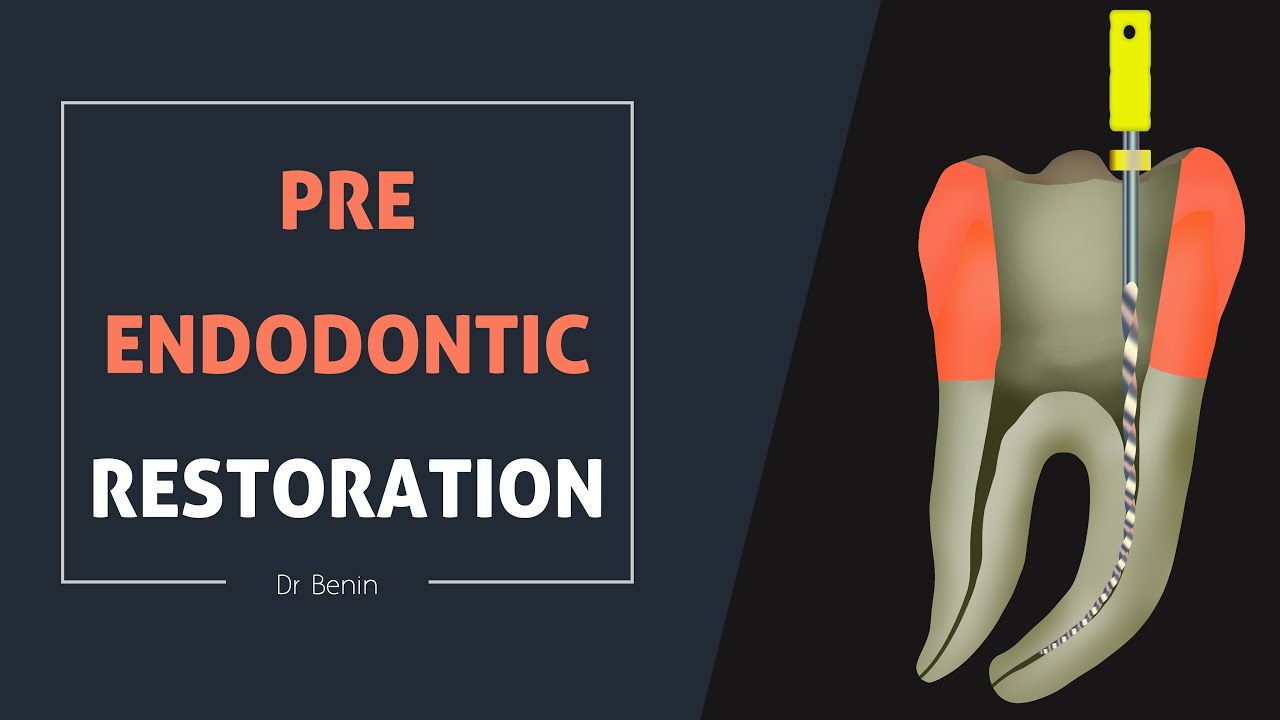 Pre Endodontic Restoration - YouTube