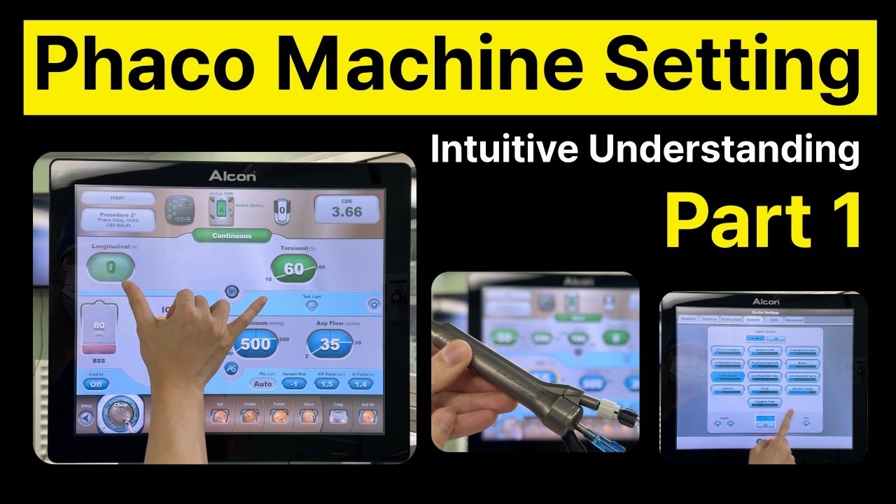 Phaco machine setting(Centurion) as beginner - YouTube