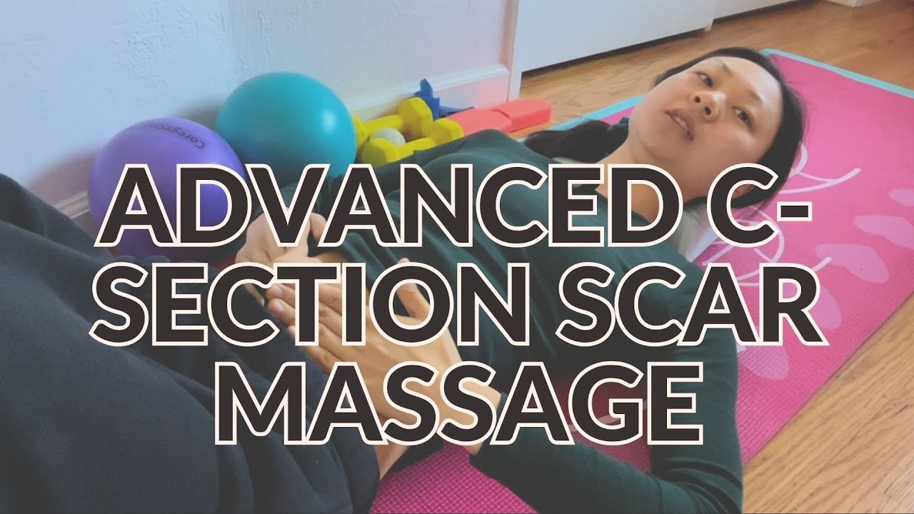 Advanced C-Section Scar Massage Techniques: Part 3 - YouTube