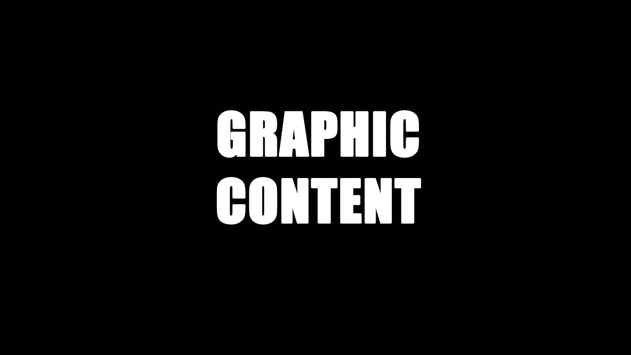 Surgical Pin Removal - YouTube