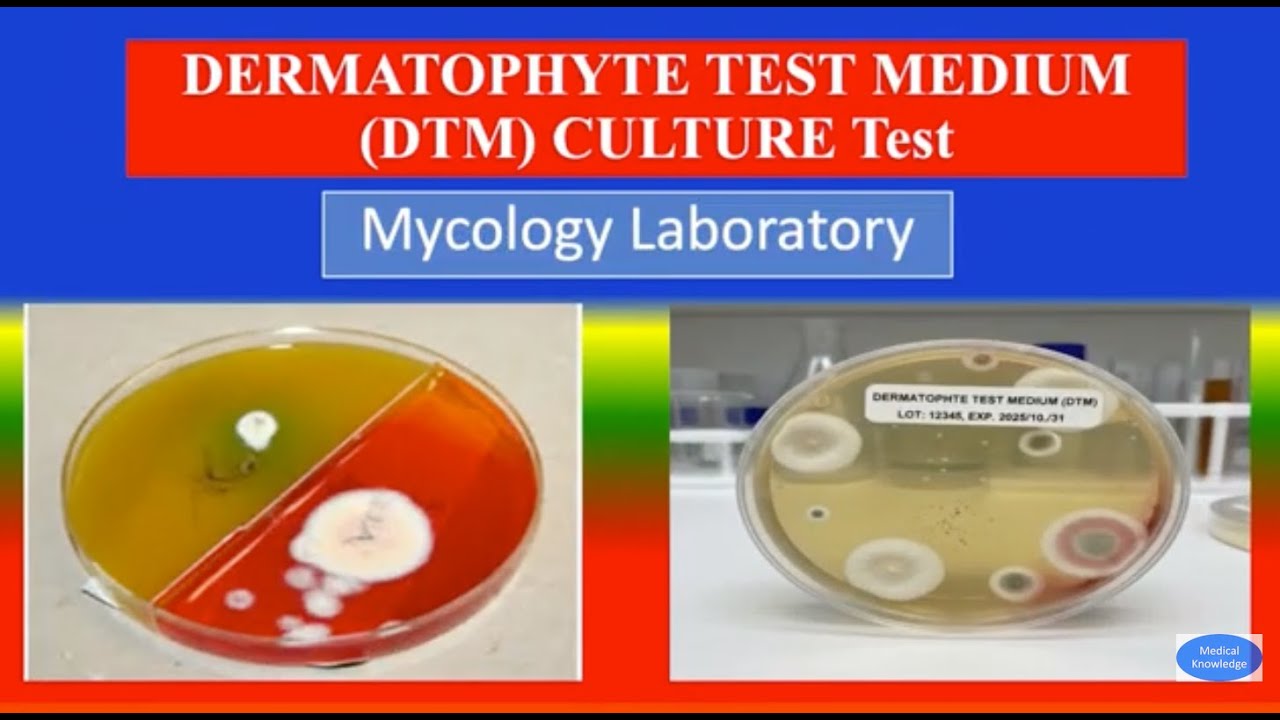 DERMATOPHYTE TEST MEDIUM (DTM) CULTURE Test -Definition , Uses , Need ...