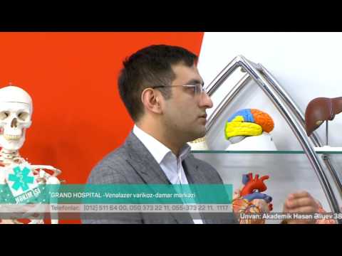 16 03 2017 Hekim ishi GRAND HOSPİTAL  Venalazer varikoz damar mərkəzi Damar Cərrahı Aydın Bayramov
