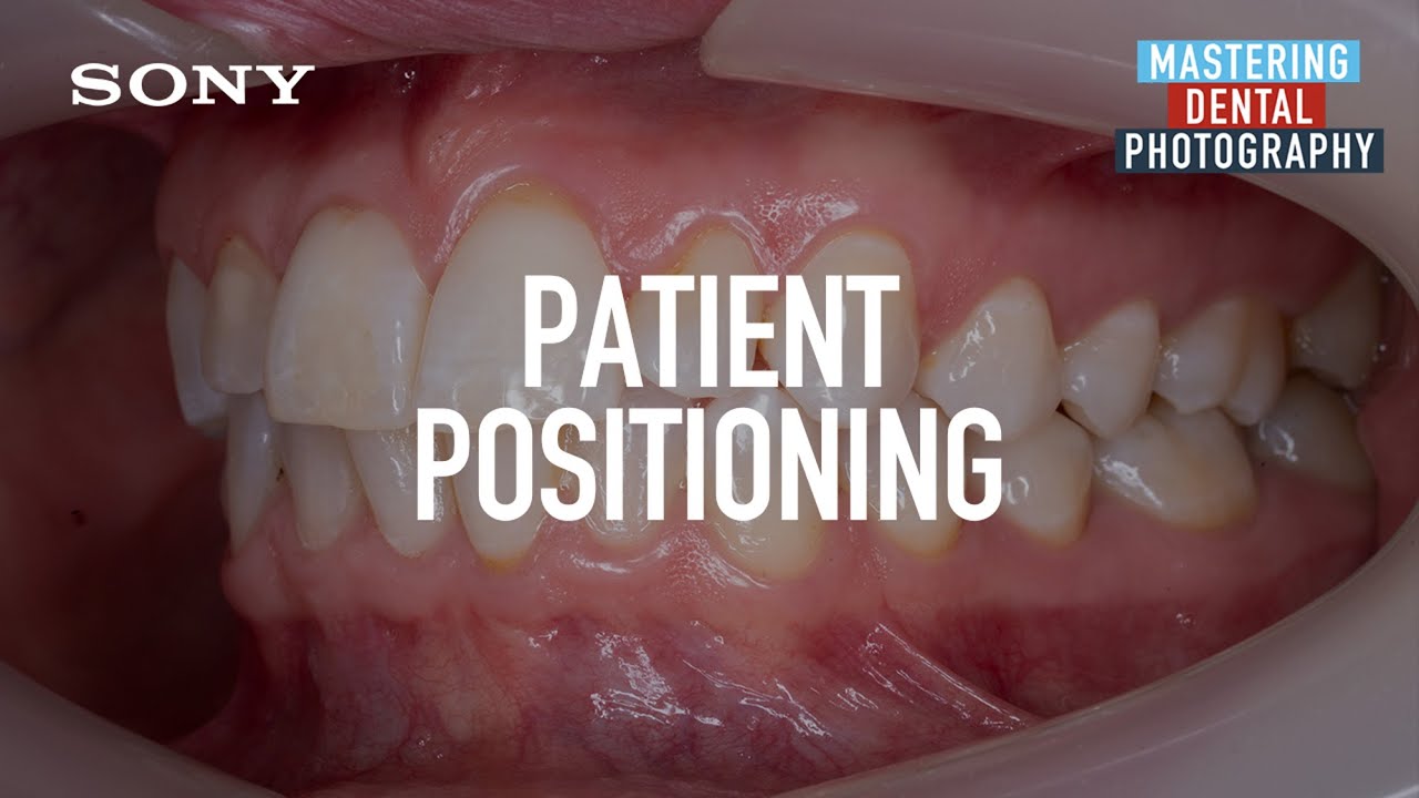 Dental Photography: How to position the patient - YouTube