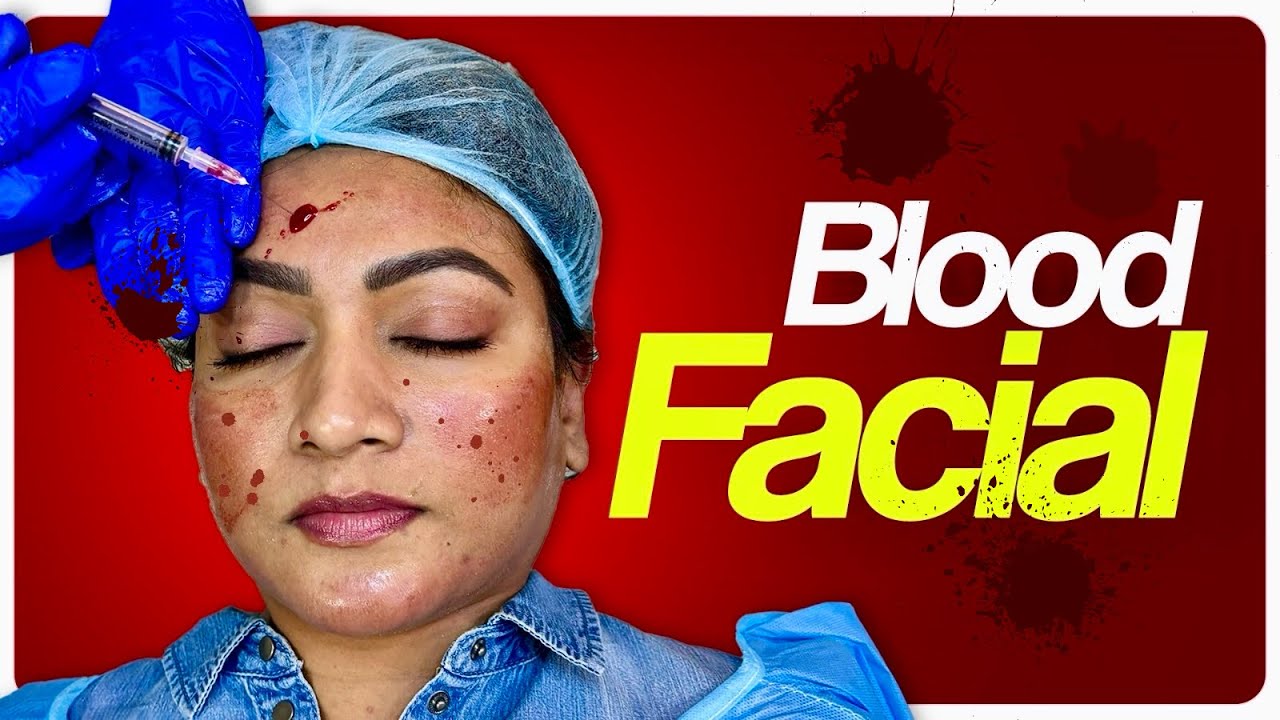 SHOCKING results with Blood facial || Vampire facial || Ashtrixx - YouTube