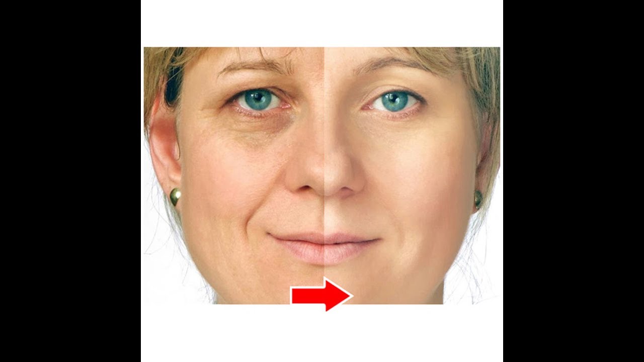 Argireline Eye Cream Instantly Ageless Cream, - YouTube