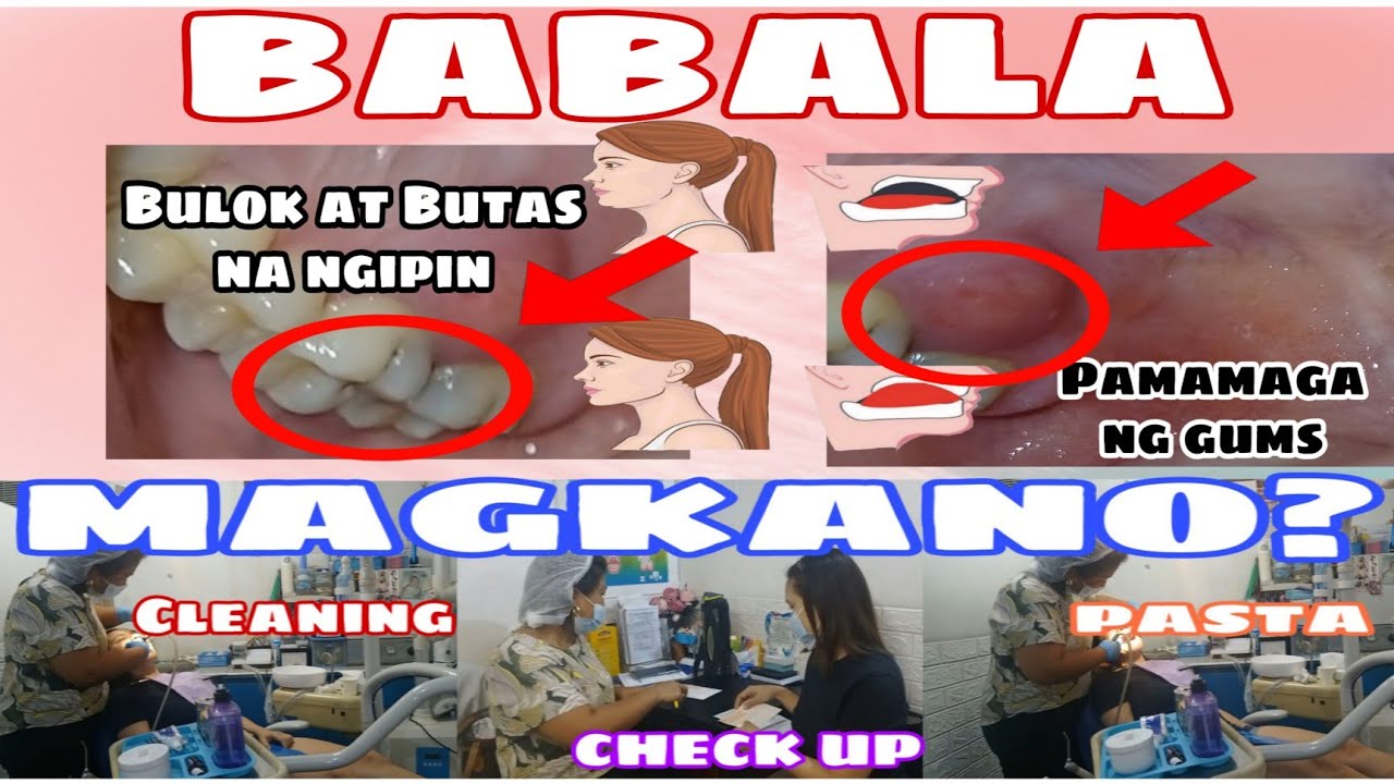 DENTAL Price💸 for 2022 Check-up, Pasta, Tooth extractions, Cleaning ...