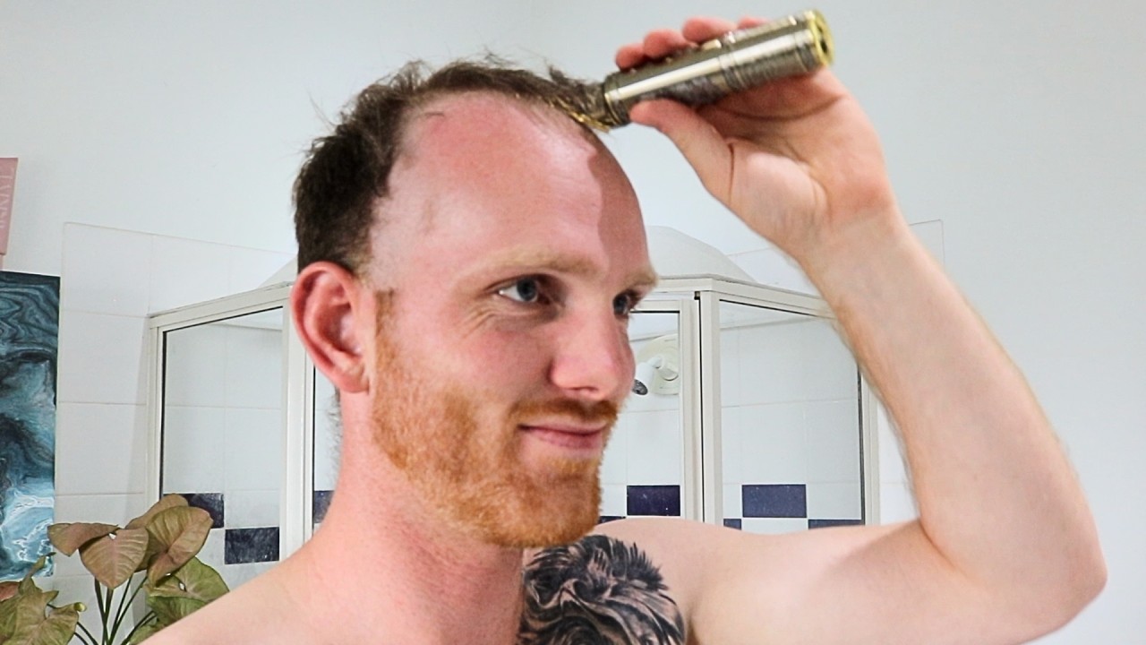 BALDING MAN'S BALD HEAD SHAVE TRANSFORMATION WOW's HIS GIRLFRIEND 😳 ...