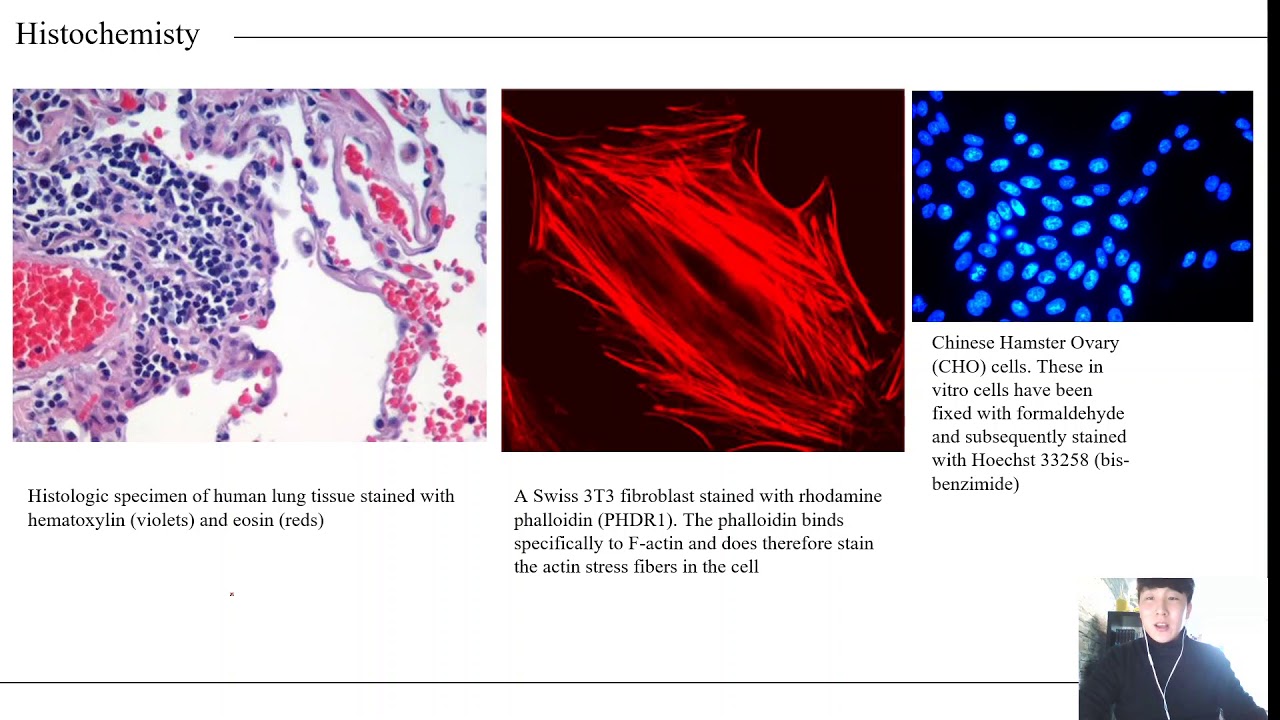 [식물생리학] GUS staining, GUS assay - YouTube