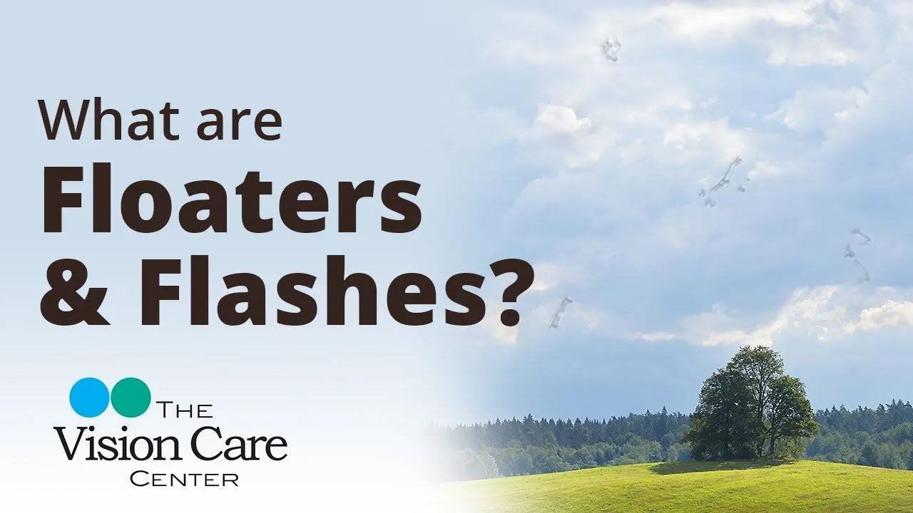 Dr. Miller answers the question, "What are Floaters and Flashes?" - YouTube