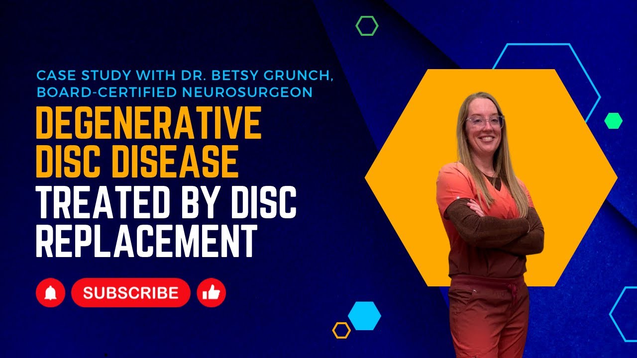Case study 102 - degenerative disc disease treated by disc replacement ...