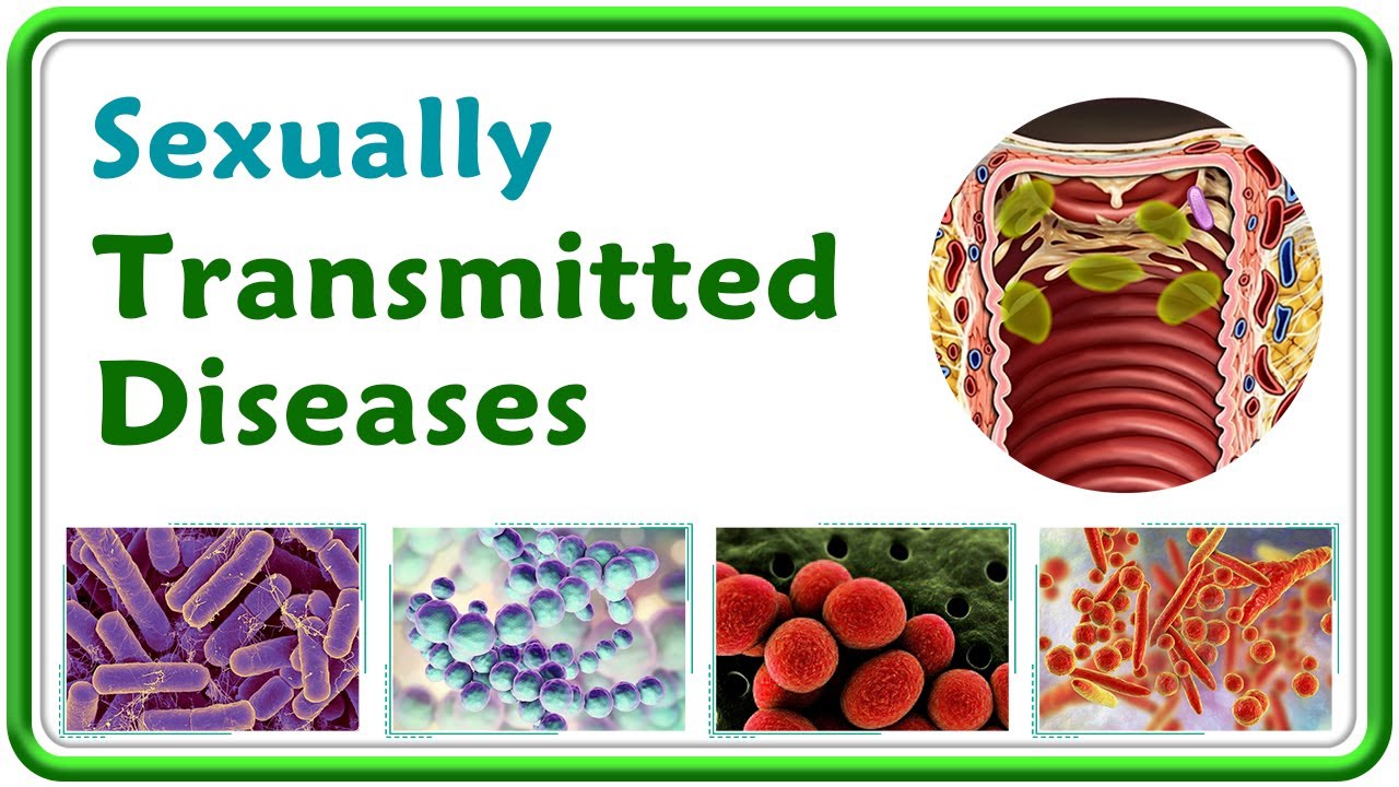 Sexually Transmitted Diseases : Bacterial Vaginosis Animation | USMLE ...