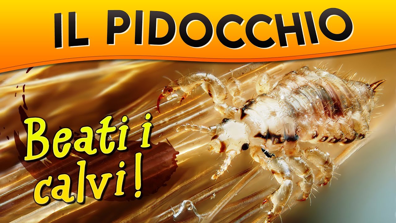 Il Pidocchio: beati i calvi! Puntata 45 - YouTube
