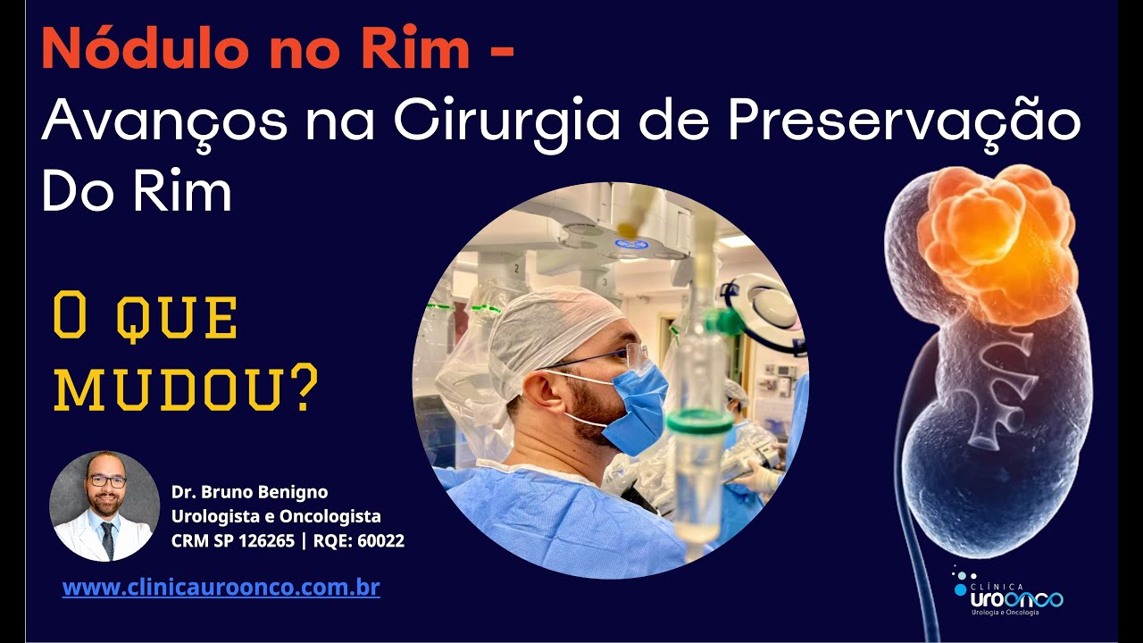 Nódulo no Rim: As Melhores Estratégias para Preservar Seu Rim e Evitar ...