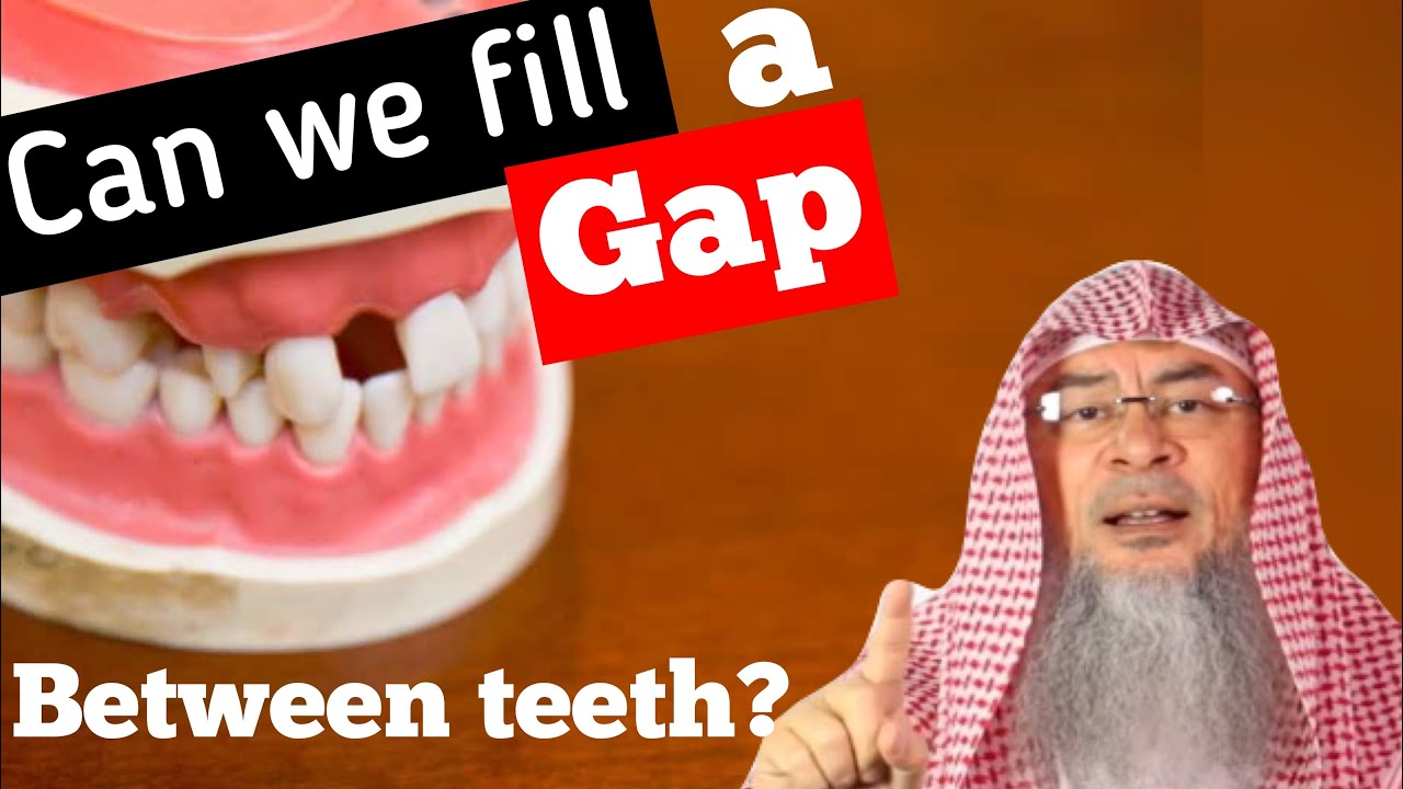 Is it permissible to close a gap between the teeth? | Sheikh Assim Al ...