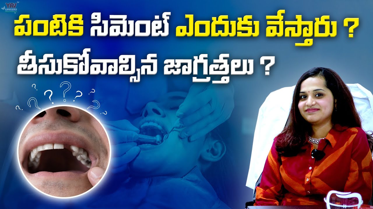 పంటికి సిమెంట్ ఎందుకు వేస్తారు ? | Teeth Filling in Telugu | Dr Vishnu ...