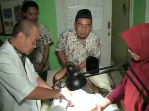 Circumcision Khitanan Sunatan Tuli