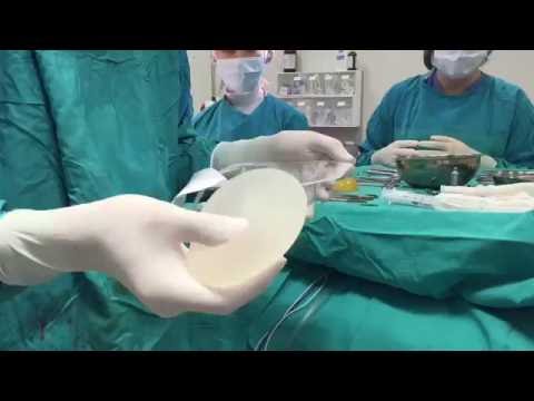 Meme Protezi | Doç. Dr. Süleyman Taş