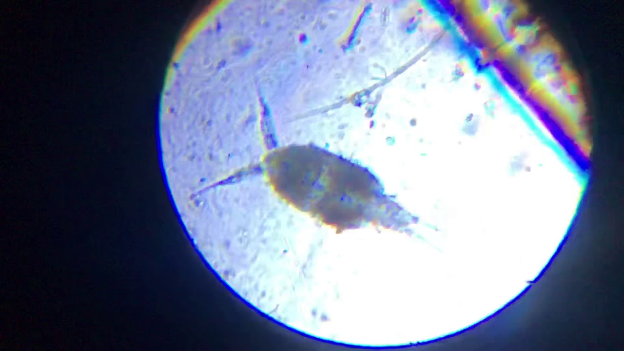 SALTWATER COPEPOD UNDER MICROSCOPE - YouTube