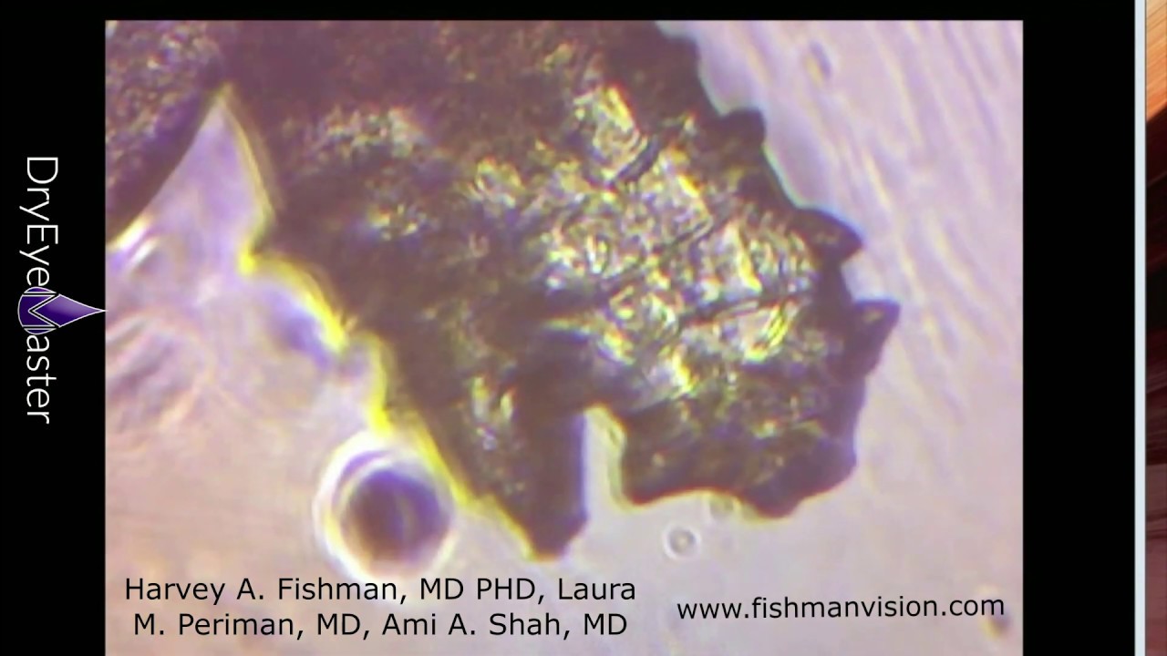 Death By IPL - Demodex Mite on Eyelash - YouTube