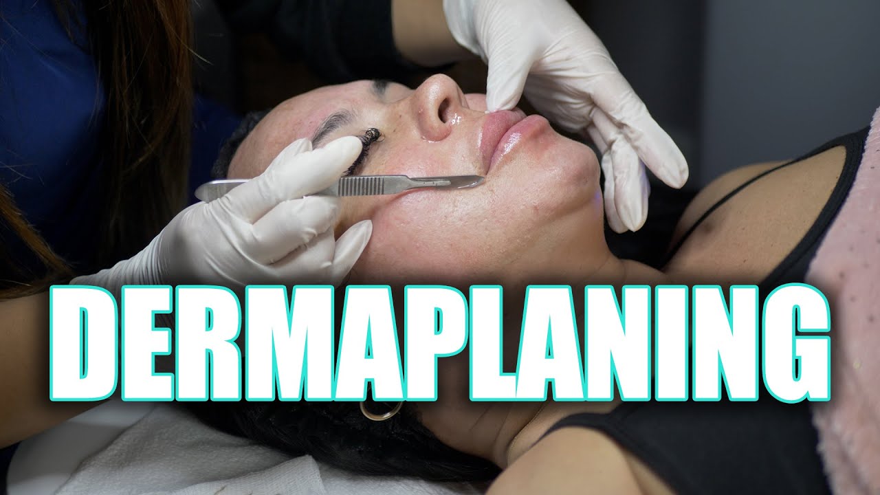 Dermaplaning - Non-Surgical Skin Surface Treatment Reduce Acne Scars ...