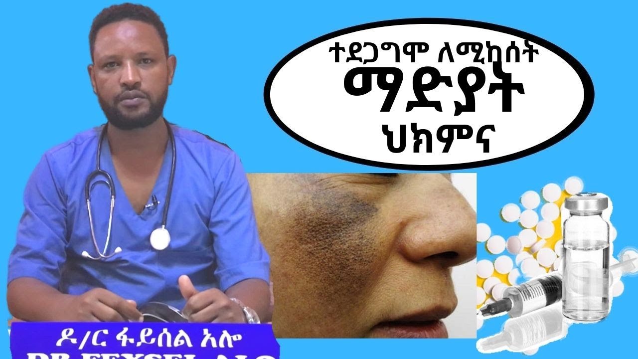 ተደጋግሞ ለሚከሰት ማድያት ህክምና -/Tranexamic acid / Melasma Treatment in Amharic ...
