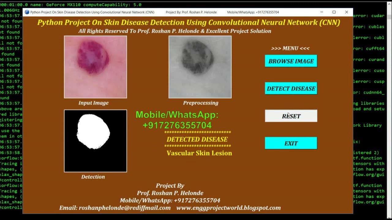 Skin Disease Detection Using CNN Convolutional Neural Network || Python OpenCV Project Source ...